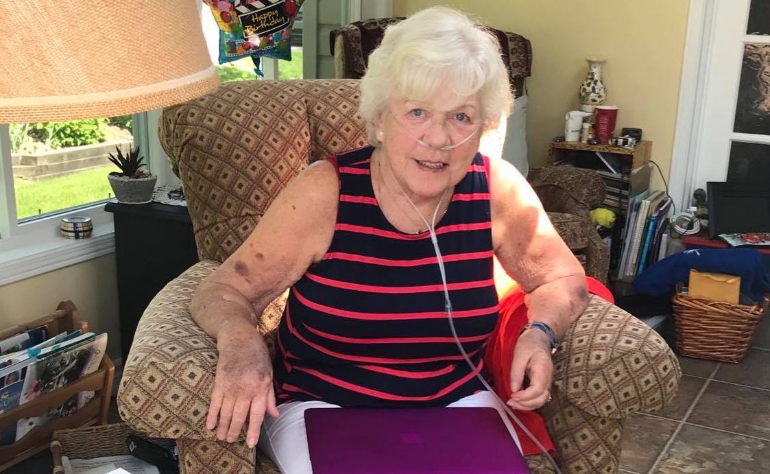 Suffering from COVID-19— months after recovering - Anglican Journal